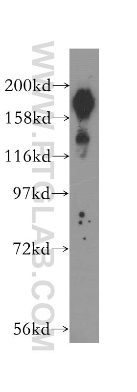 BCOR 抗体 | 免疫組織化学染色（IHC）適用！遺伝子発現の抑制、阻害に関わる因子 | コスモ・バイオ株式会社