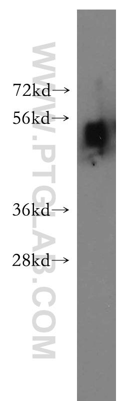 CDS2 抗体 | コスモ・バイオ株式会社