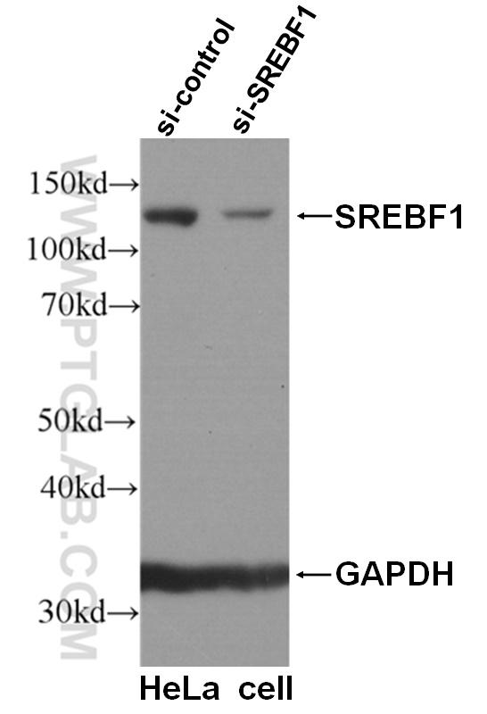 SREBF1 抗体 | 80報以上の文献使用実績！ | コスモ・バイオ株式会社