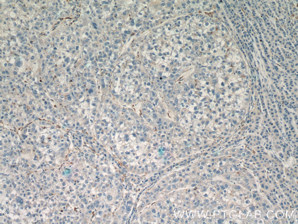 CD68 抗体 | 免疫組織化学染色（IHC）適用！単球／マクロファージで発現するマーカー | コスモ・バイオ株式会社