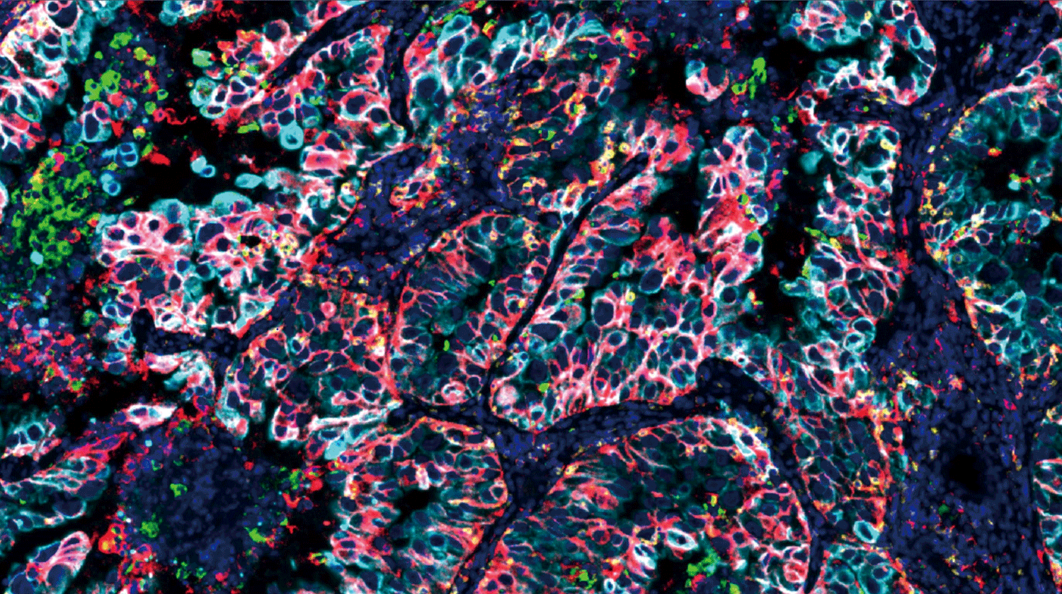 Ultivue社Multiplex IHC染色サービス | 高感度マルチプレックス免疫組織染色によるがん・免疫応答評価 | コスモ・バイオ株式会社