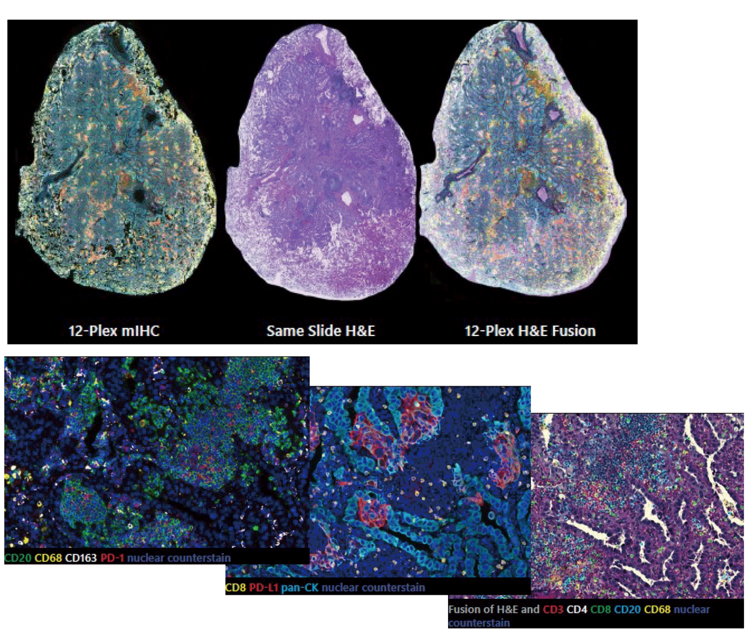 Ultivue社Multiplex IHC染色サービス | 高感度マルチプレックス免疫組織染色によるがん・免疫応答評価 | コスモ・バイオ株式会社
